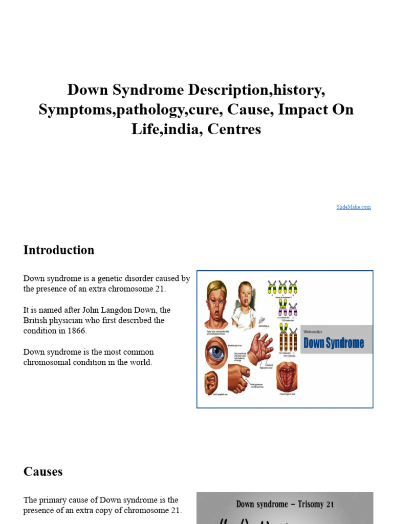 Down Syndrome Description, History, Symptoms, Pathology, Cure, Cause ...