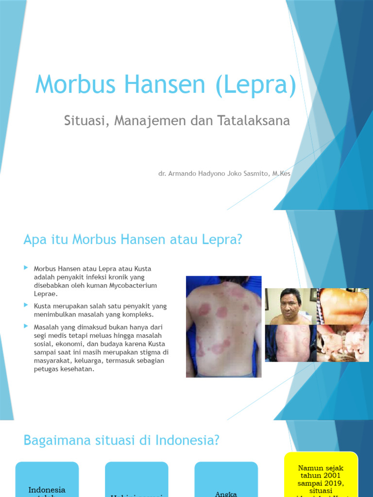 Morbus Hansen Atau Lepra (Kusta) | PDF