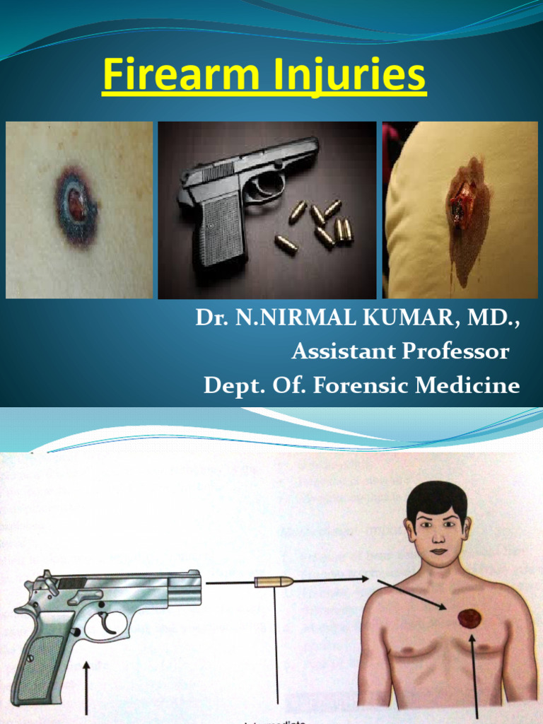 Understanding Firearm Injuries and Wound Ballistics | PDF | Gun Barrel ...