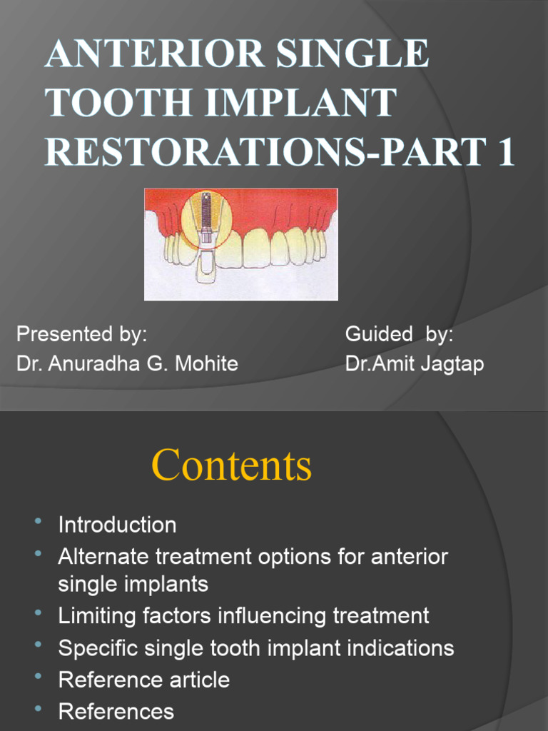 Anterior Single Tooth Implant Part1 | PDF | Dental Implant | Medical ...
