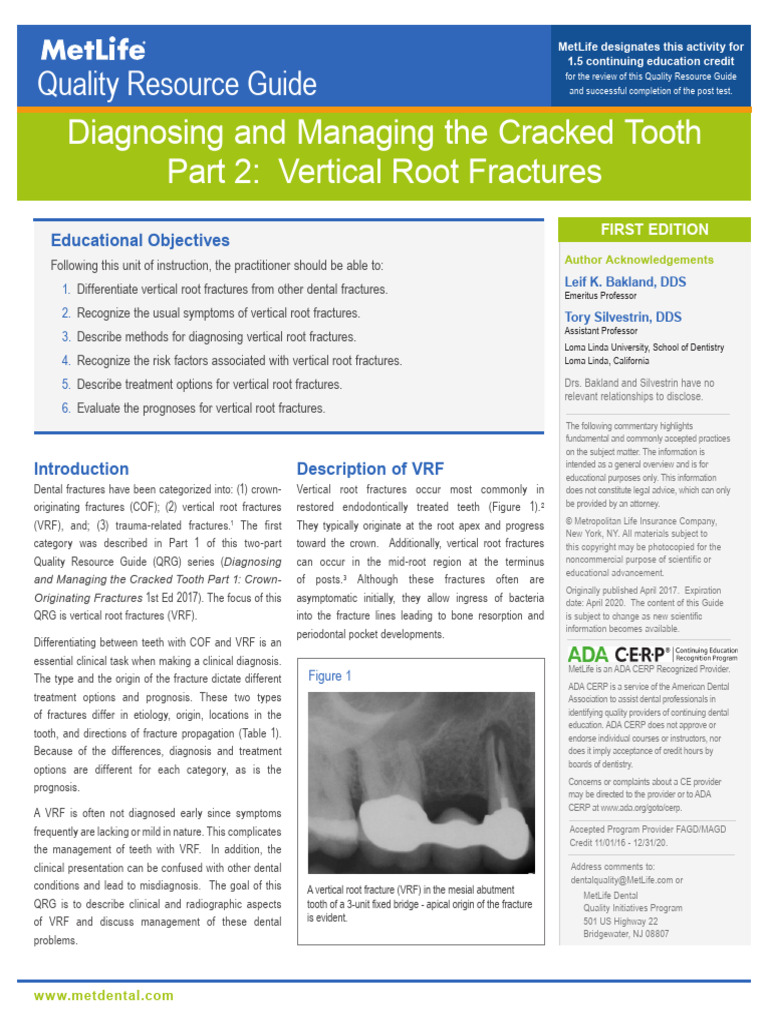 Fractura Vertical | PDF | Human Tooth | Dental Implant