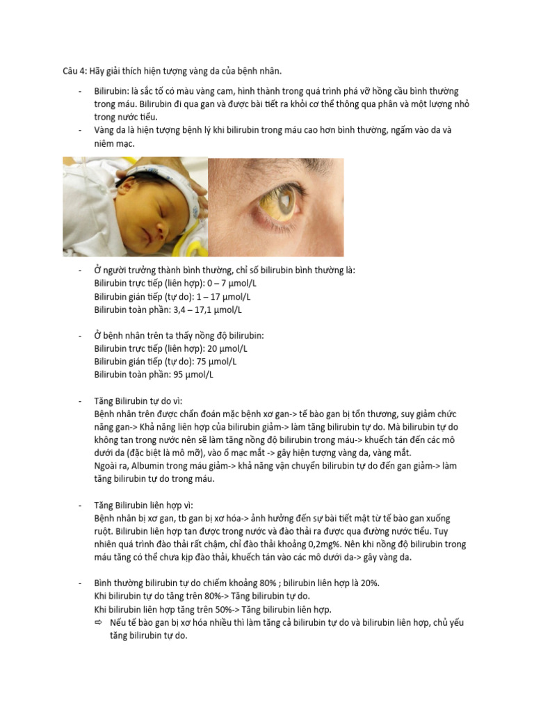 Ycs2 Case Xơ Gan | PDF