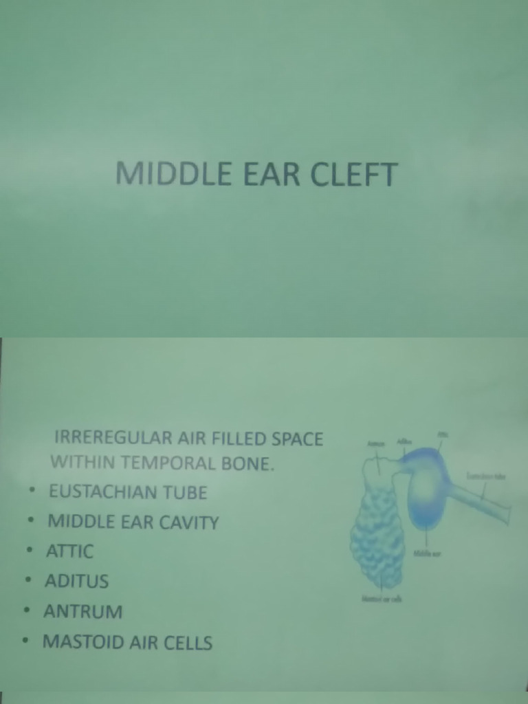 Middle Ear Anatomy | PDF