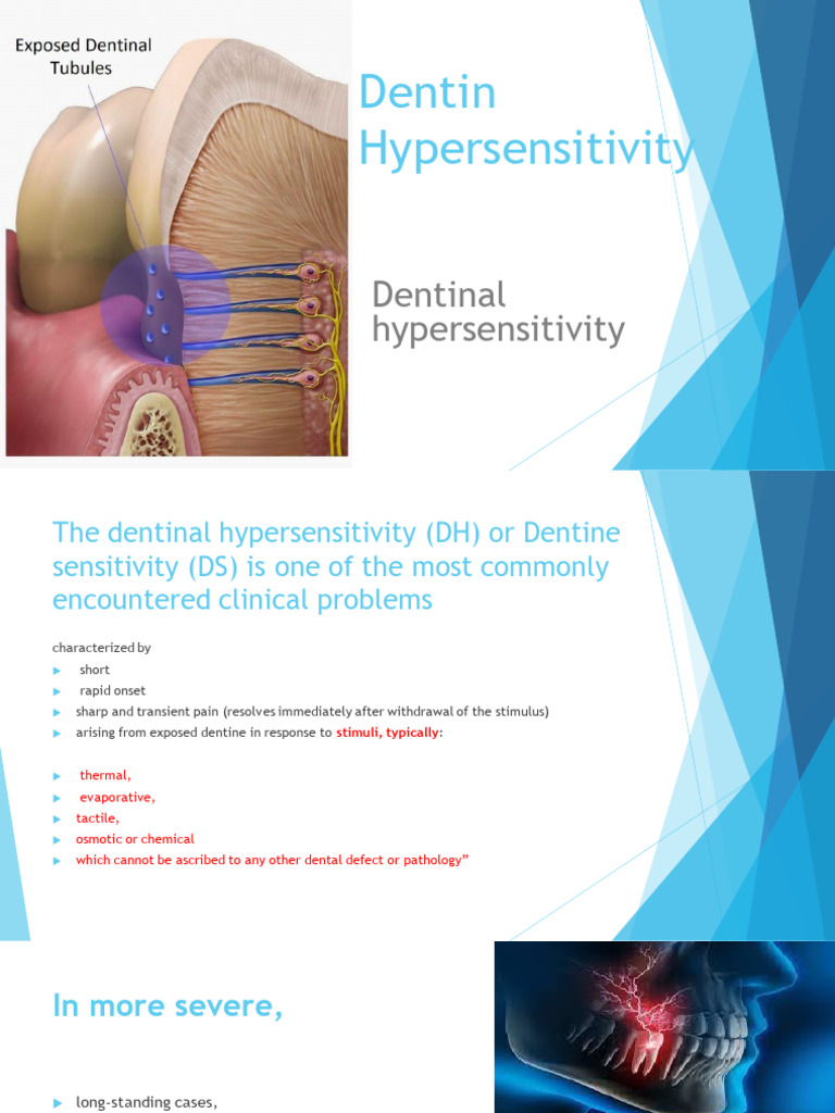 Dentin Hypersensitivity 2024 | PDF | Human Tooth | Dentin