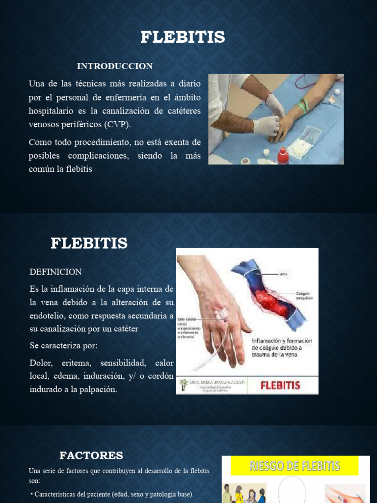 Flebitis Exposicion | PDF | Lavado de manos | Especialidades Medicas