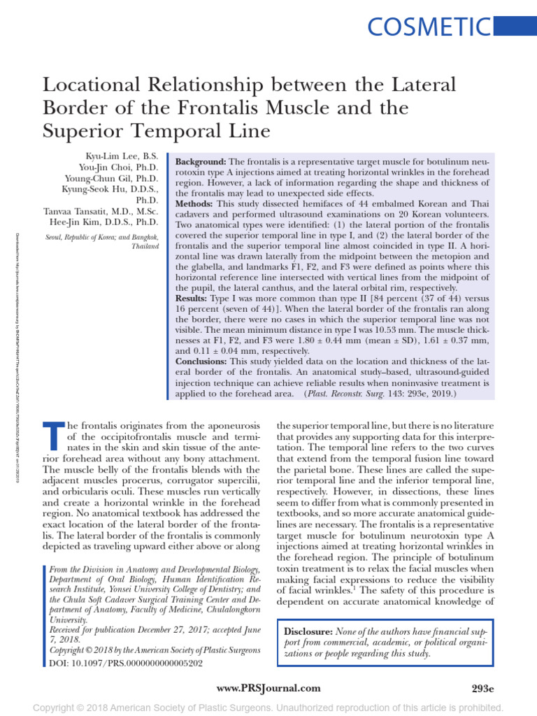 Locational Relationship Between The Lateral Border of The Frontalis ...