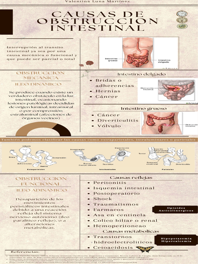 Infografía Causas Obstruccion Intestinal | PDF | Medicina CLINICA ...