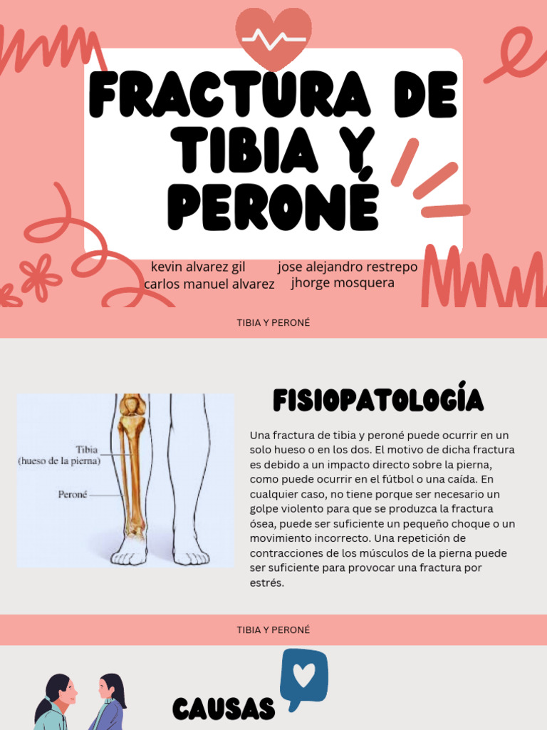 Fractura de Tibia y Perone | PDF | Hueso | Enfermedades y trastornos
