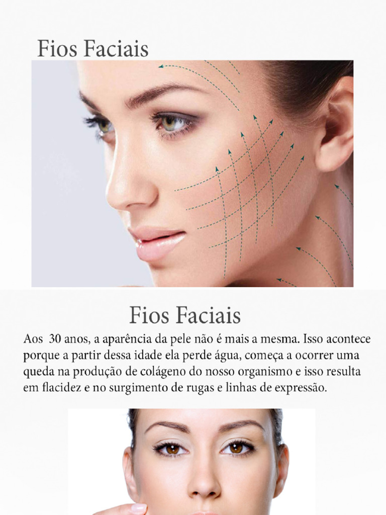 Fios Faciais De Pdo Marilia Pdf