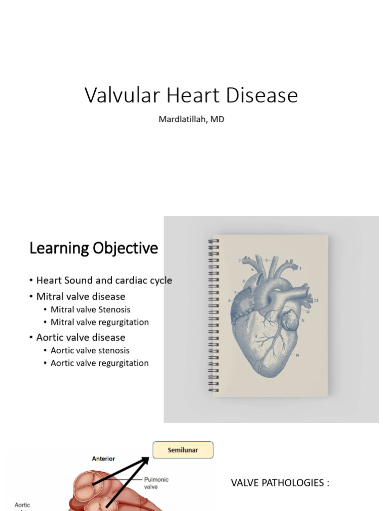 Kelainan Katup Jantung Nopasa | PDF | Heart Valve | Heart