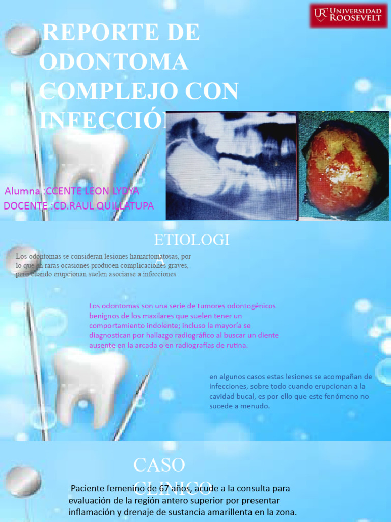 Odontoma Complejo con Infección: Caso Clínico | PDF | Medicina CLINICA ...