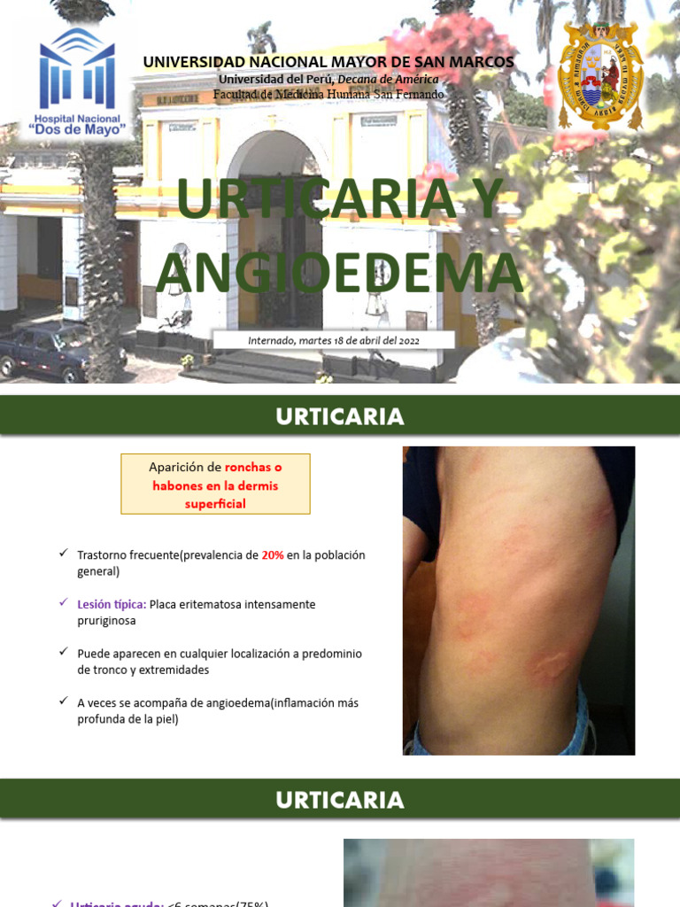 URTICARIA Y ANGIOEDEMA | PDF | Alergia | Medicina CLINICA