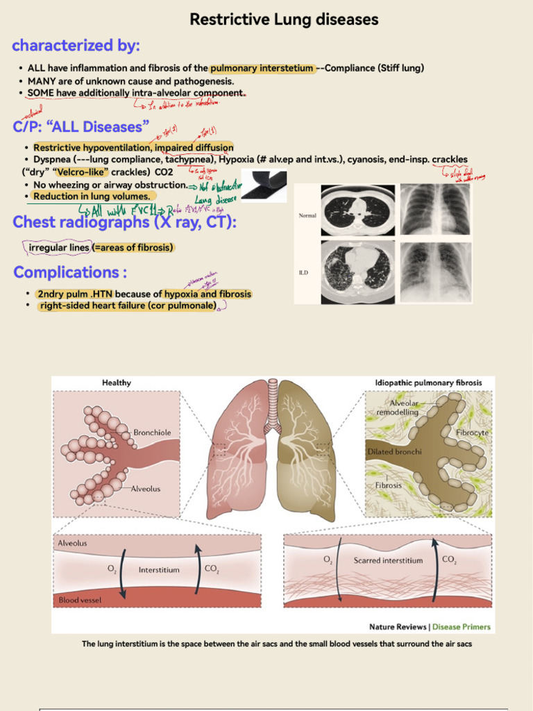 Pneumoconiosis Lecture - 202406051726 - 27103 2 | PDF | Respiratory ...