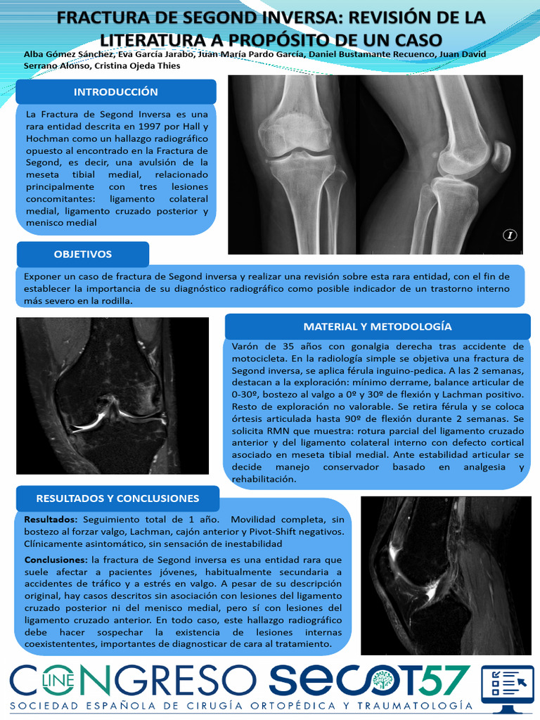 Fractura de Segond Inversa: Diagnóstico y Manejo | PDF | Rodilla ...