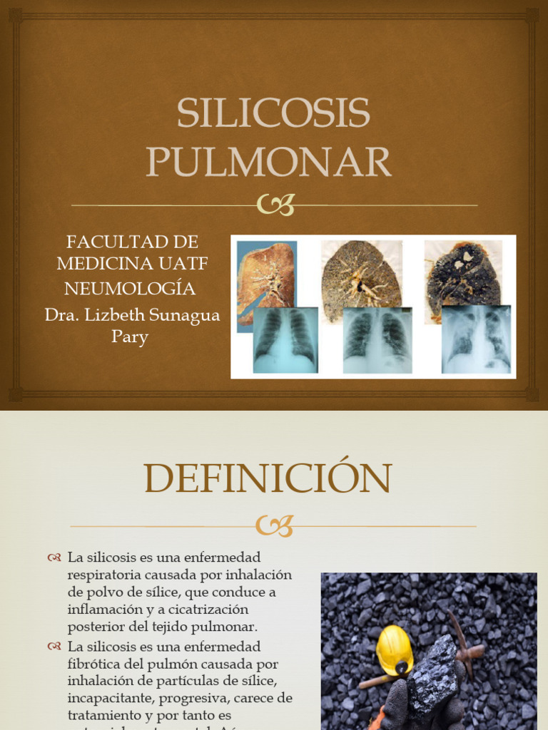 Silicosis Pulmonar | Descargar gratis PDF | Medicina | Medicina CLINICA