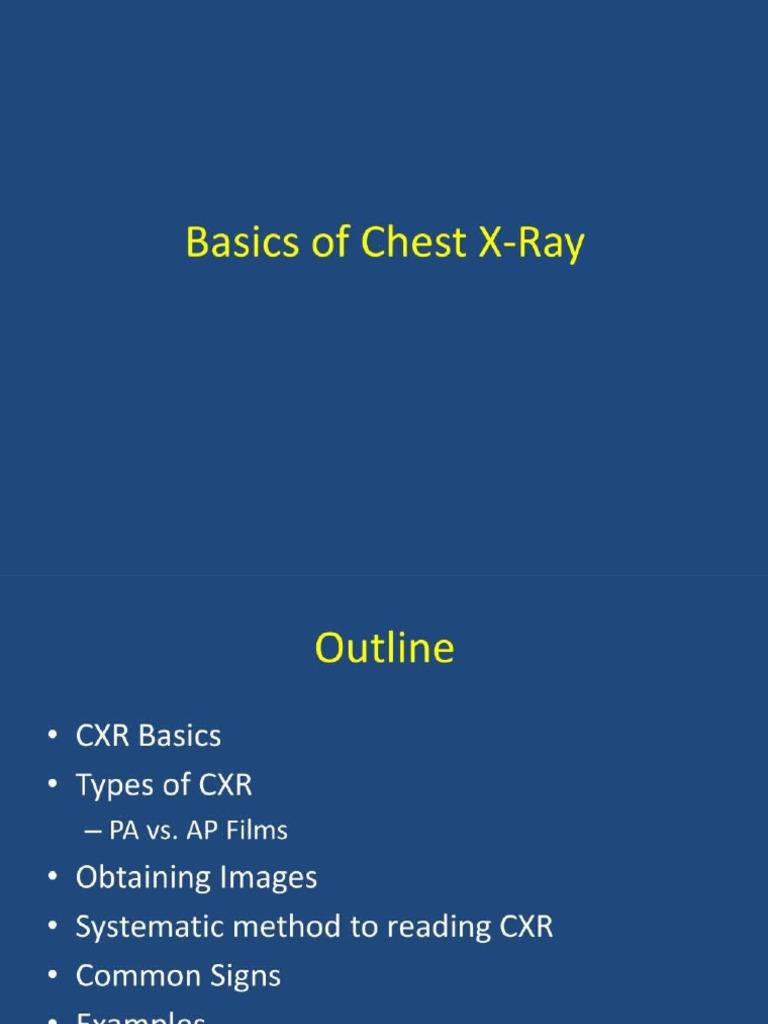 Chest X Ray-1 | PDF
