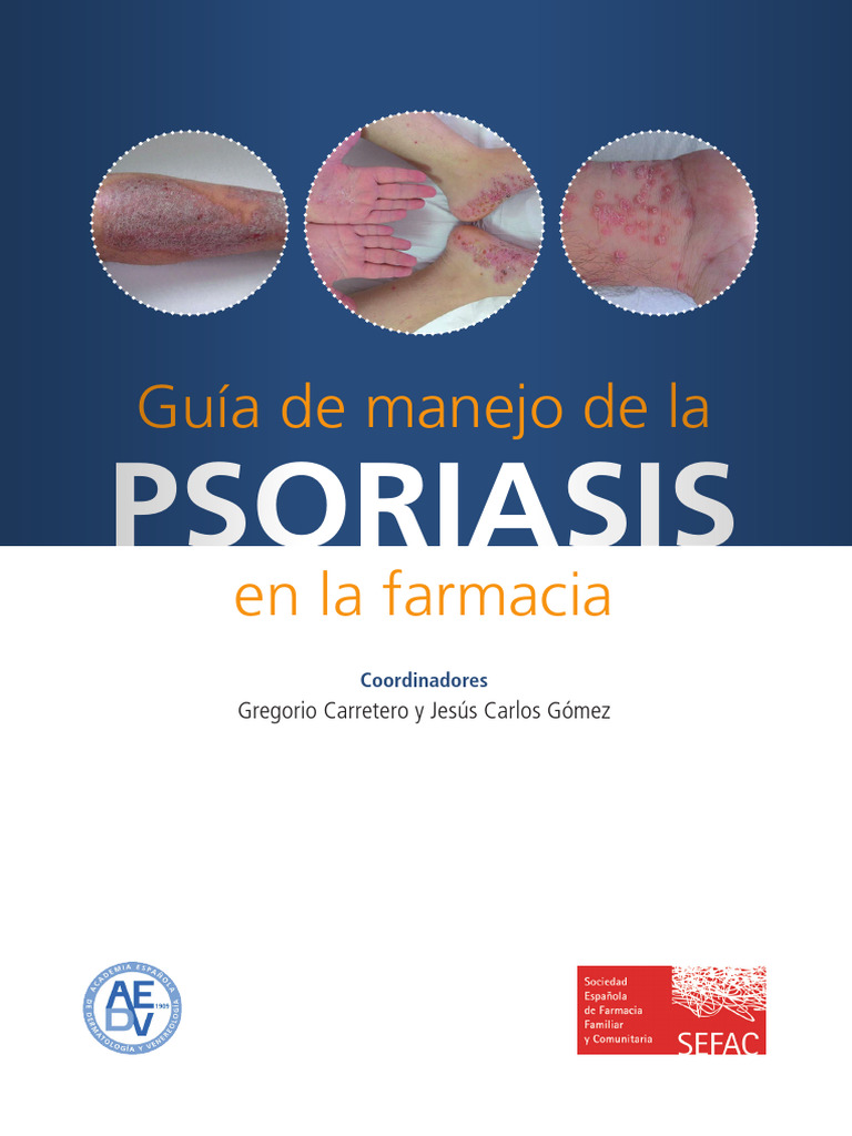 Guia Psoriasis | Descargar gratis PDF | Psoriasis | Sistema inmune