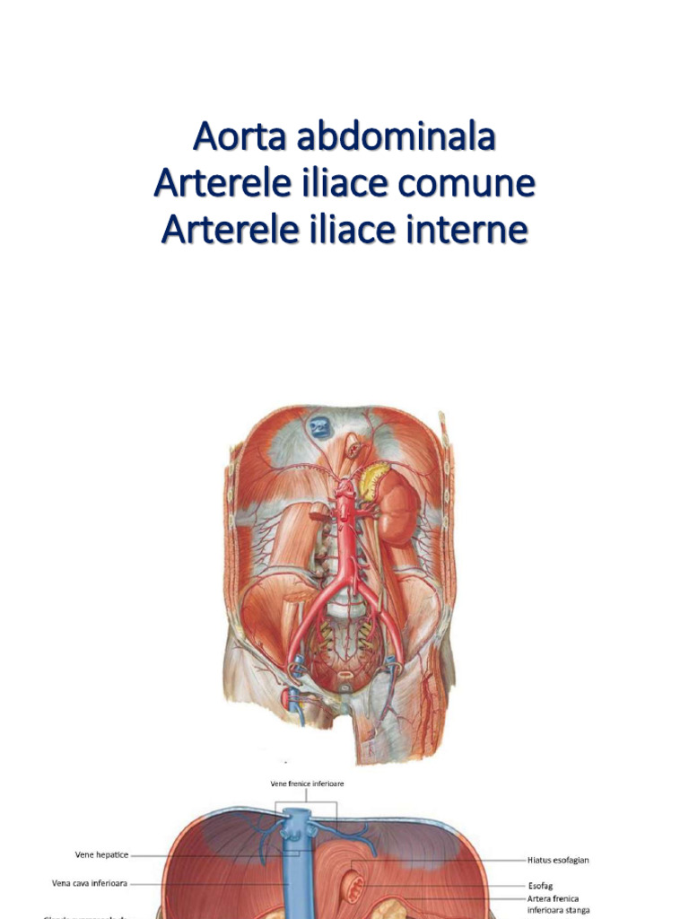 Curs 11. Aorta Abdominala, Arterele Iliace Comune, Arterele Iliace ...