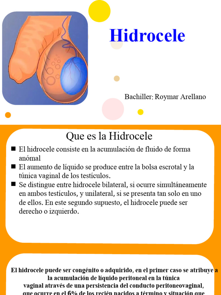 Hidrocele Diapositivas | PDF | Especialidades Medicas | Medicina CLINICA