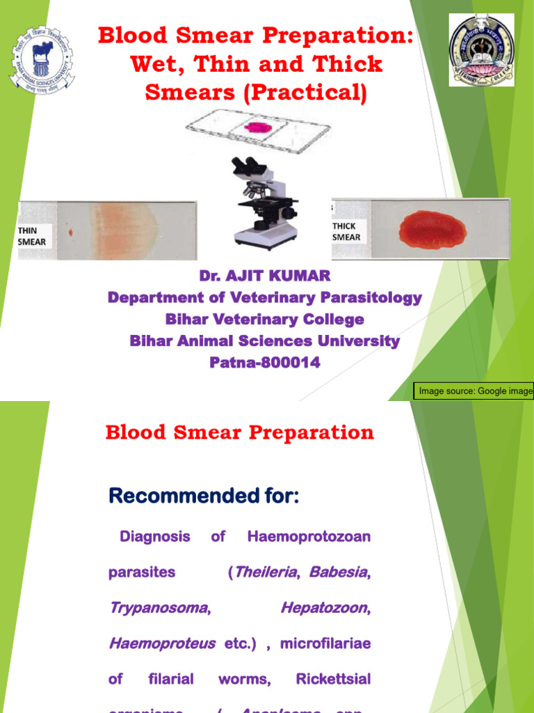 Blood Smear Preparartion - Wet Thin Thick Smears Practical | PDF ...
