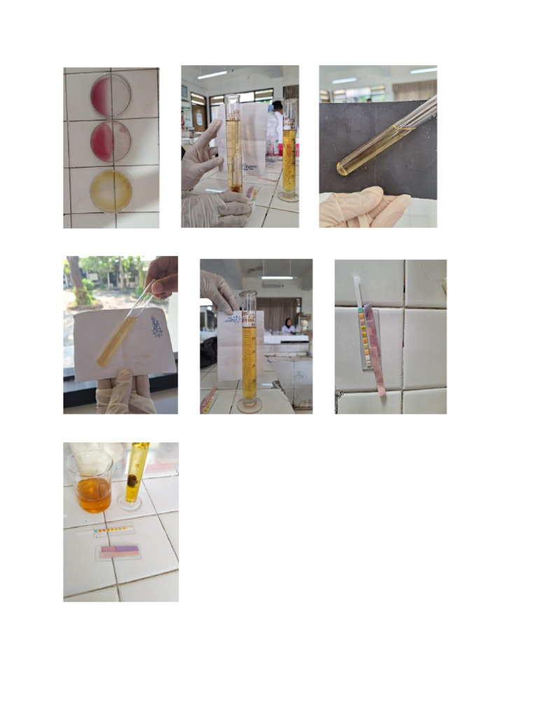 urine 2, bakter 3 | PDF