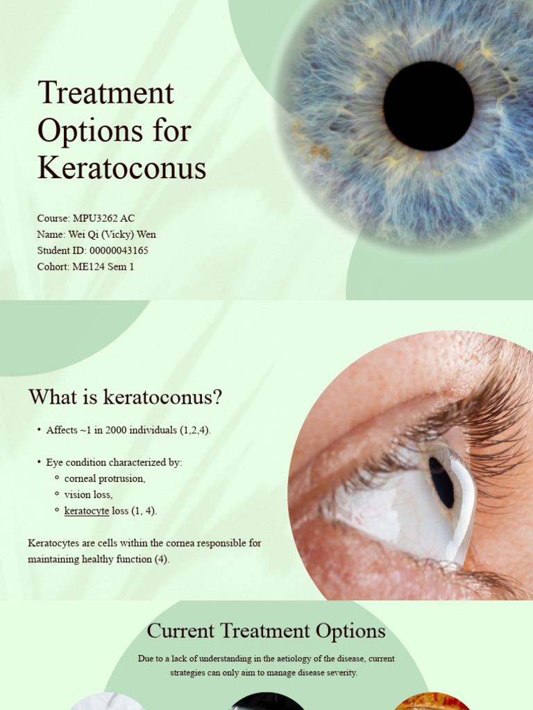 Treatment Options For Keratoconus | PDF | Clinical Medicine | Diseases And Disorders