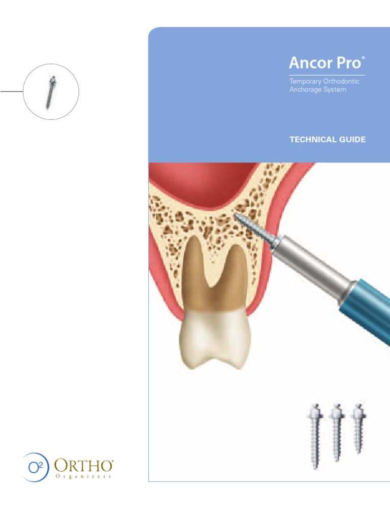 Ancor Pro | PDF | Anchor | Orthodontics