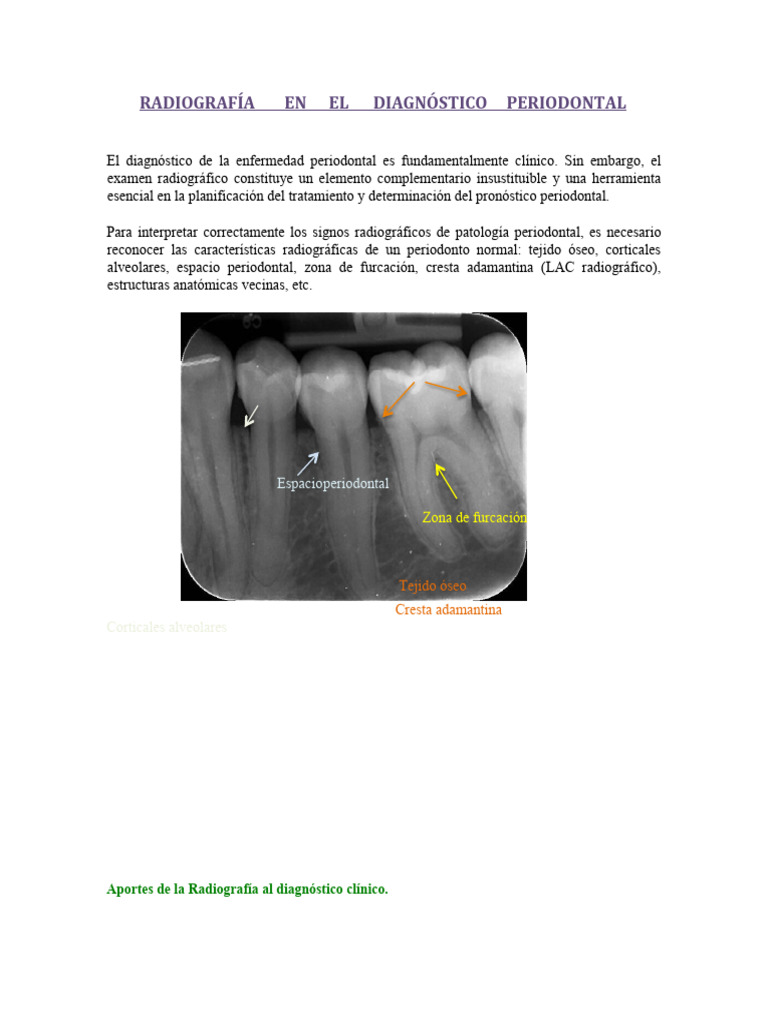 RX en El Diagnóstico Periodontal | PDF | Hueso | Odontología