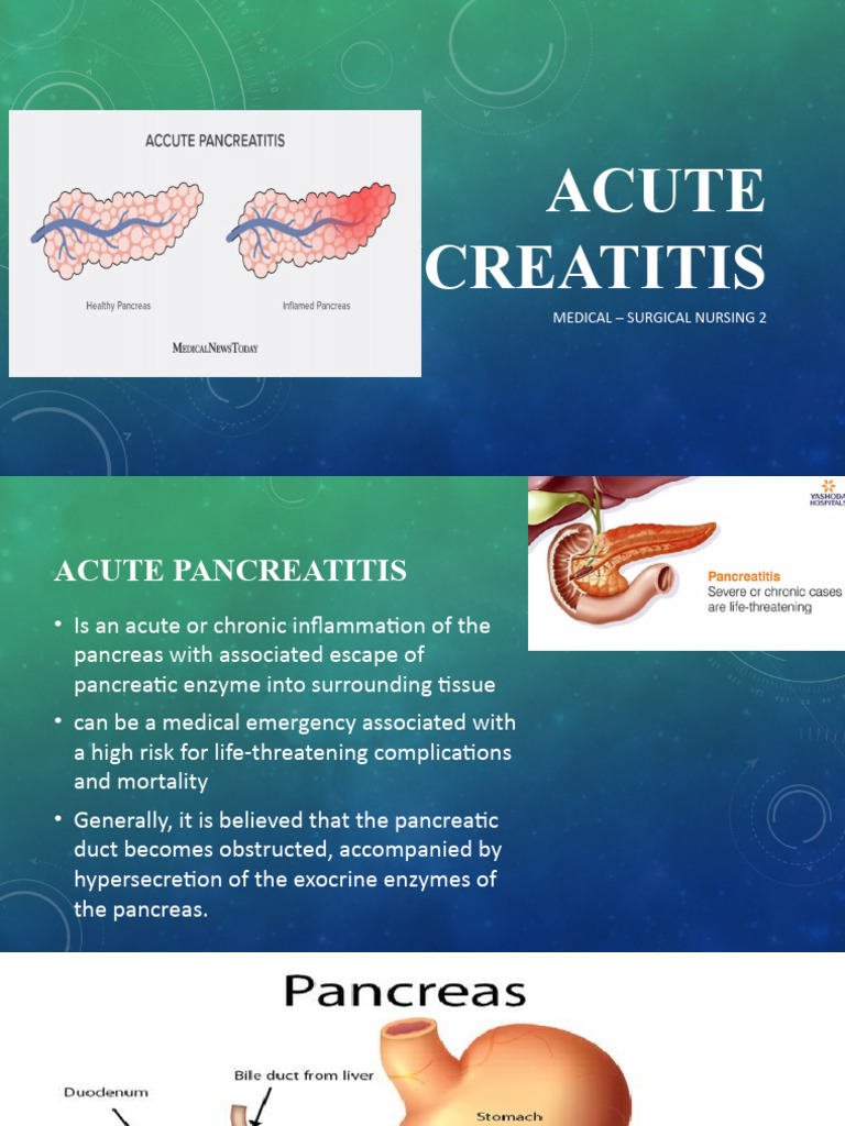 Acute Pancreatitis | Download Free PDF | Pancreas | Gastroenterology