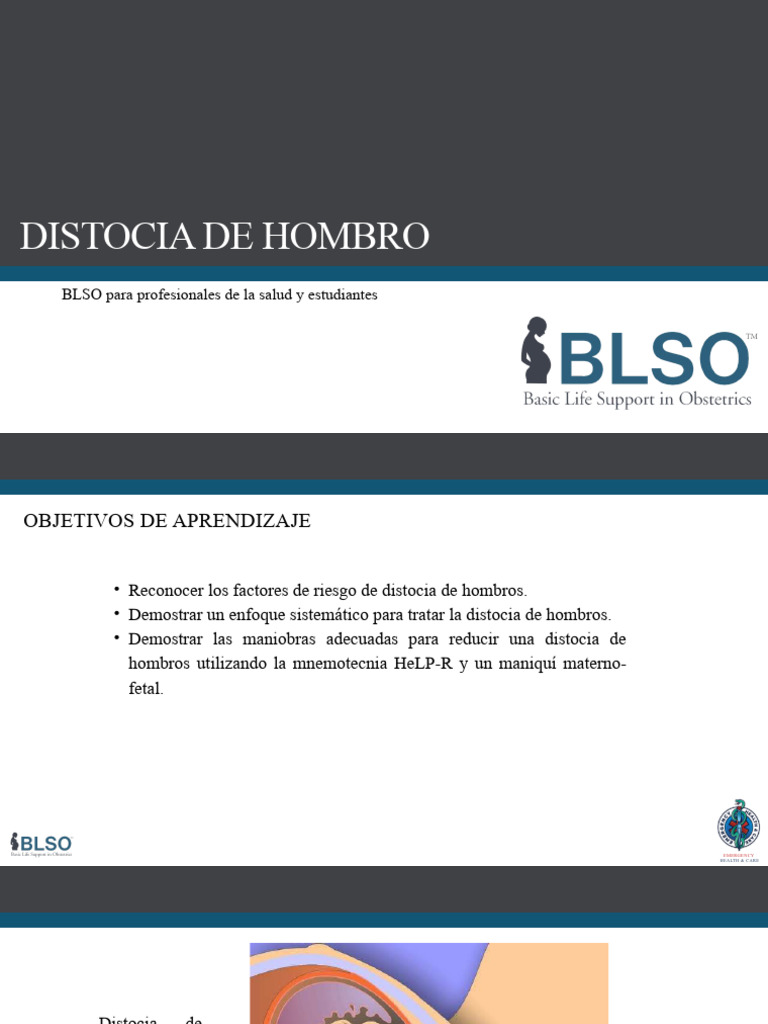 Distosia de Hombro | PDF | Parto | Especialidades Medicas