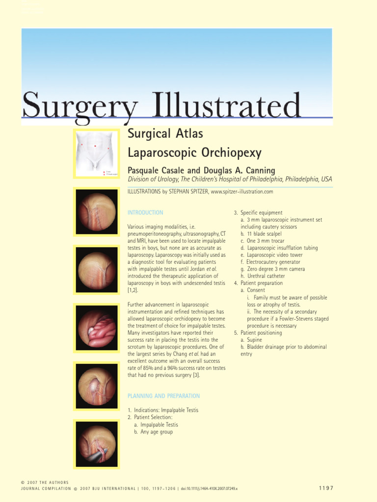 Laparoscopic Orchiopexy Guide | PDF | Medical Specialties | Clinical ...