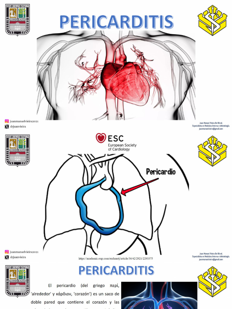 Pericarditis | PDF