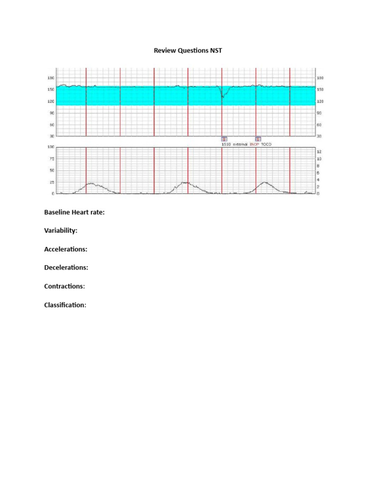 Review Questions NST | PDF | Maternal Health | Obstetrics