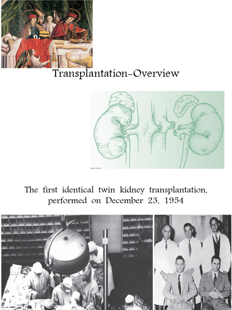 Transplantation | PDF | Transplant Rejection | T Helper Cell