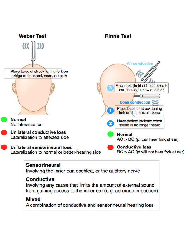 Rhine Webers Test | PDF