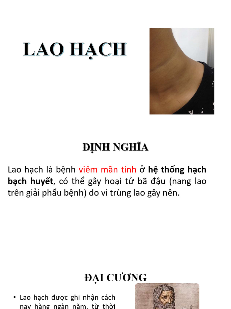 Lao H CH | PDF