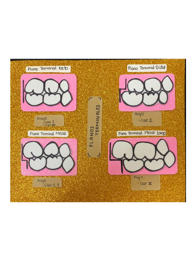 Plano Terminal Recto | PDF