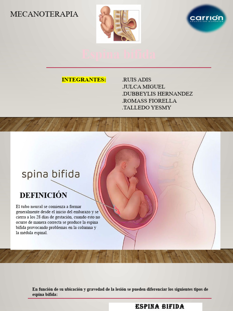 Espina Bifida | PDF | Medicina CLINICA | Enfermedades y trastornos humanos