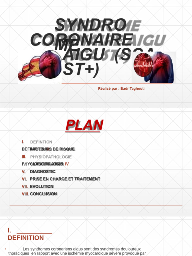 Définition du syndrome coronarien aigu | PDF | Infarctus du myocarde ...