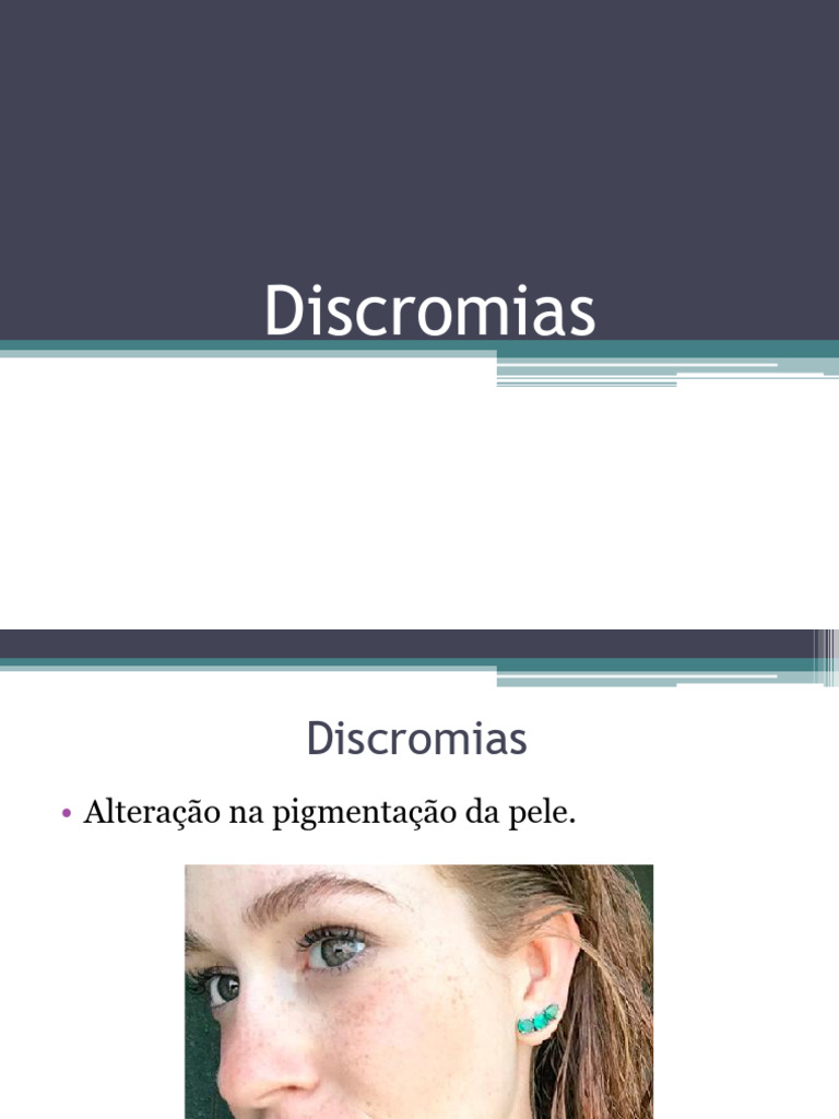 Discromias | PDF | Especialidades médicas | Pele