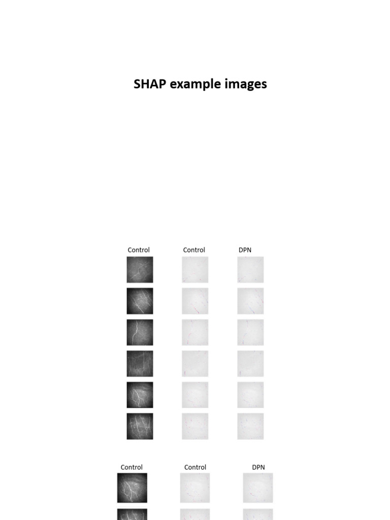 SHAP Examples | PDF