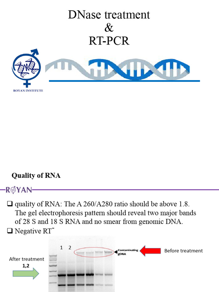 CDNA Synthesis | PDF | Reverse Transcription Polymerase Chain Reaction ...