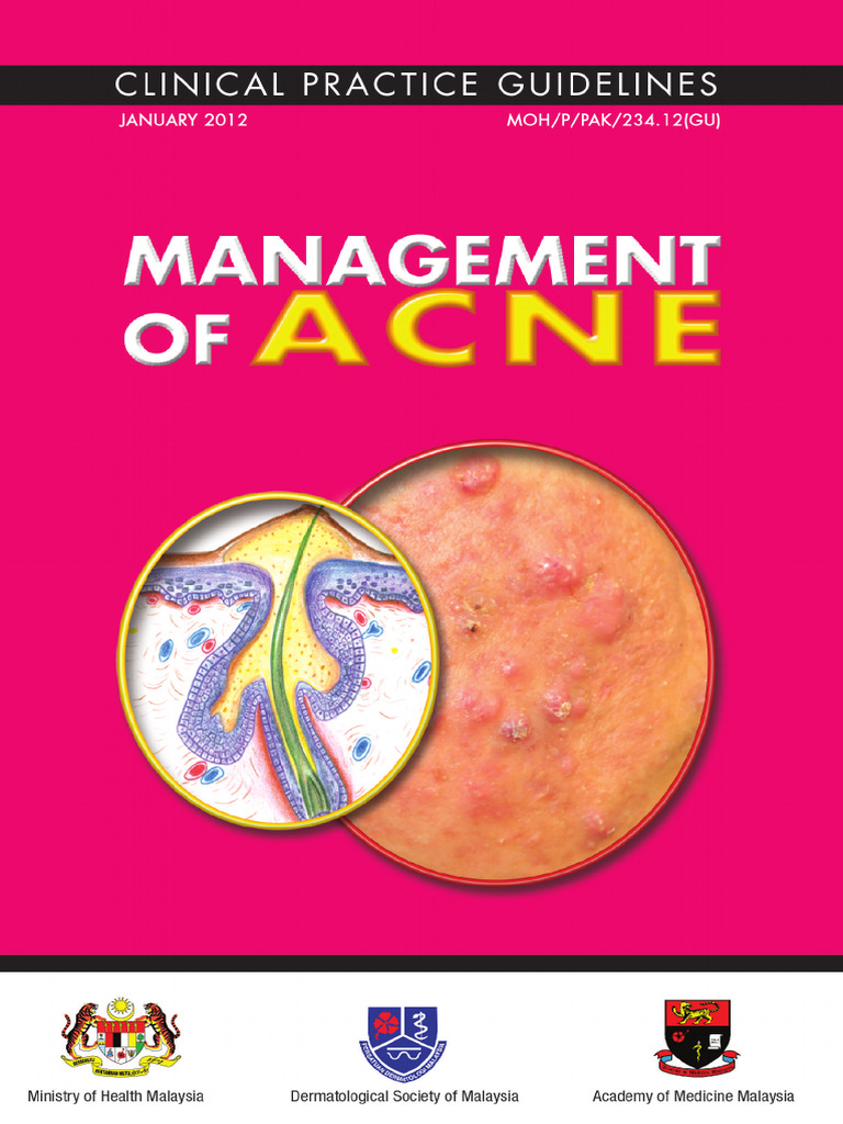 CPG - Management of Acne 2 | PDF | Interleukin 8 | Evidence Based Medicine