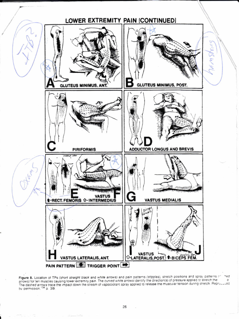 Lower Extremity Pain | PDF