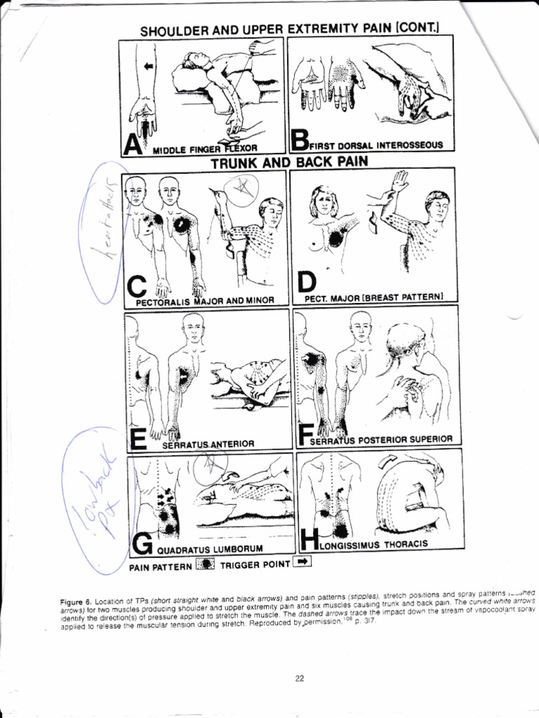 Shoulder & Upper Extremity Pain 3 | PDF | Musculoskeletal System