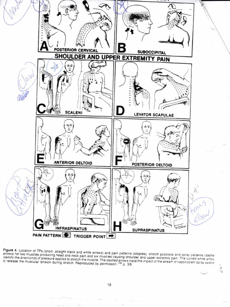 Shoulder & Upper Extremity Pain | PDF | Musculoskeletal System | Anatomy