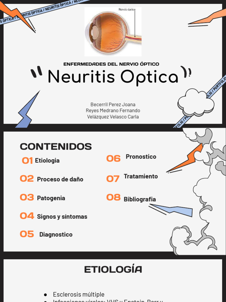 Neuritis Óptica | PDF | Esclerosis múltiple | Causas de la muerte