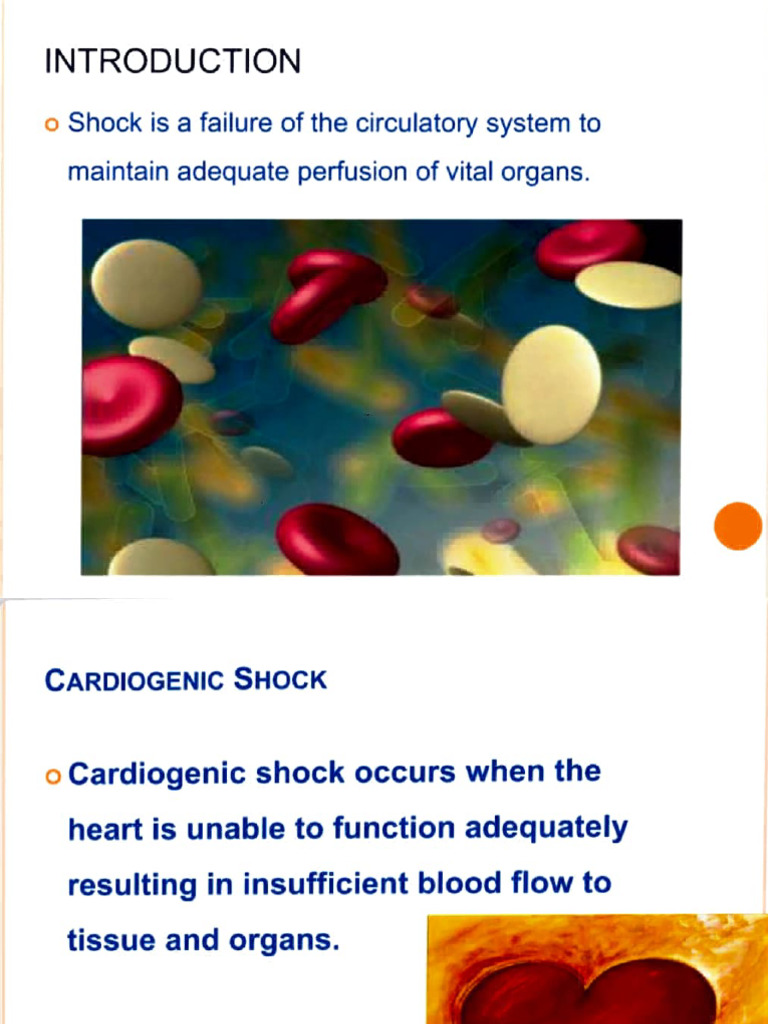 Cardiogenic Shock | Download Free PDF | Shock (Circulatory) | Heart