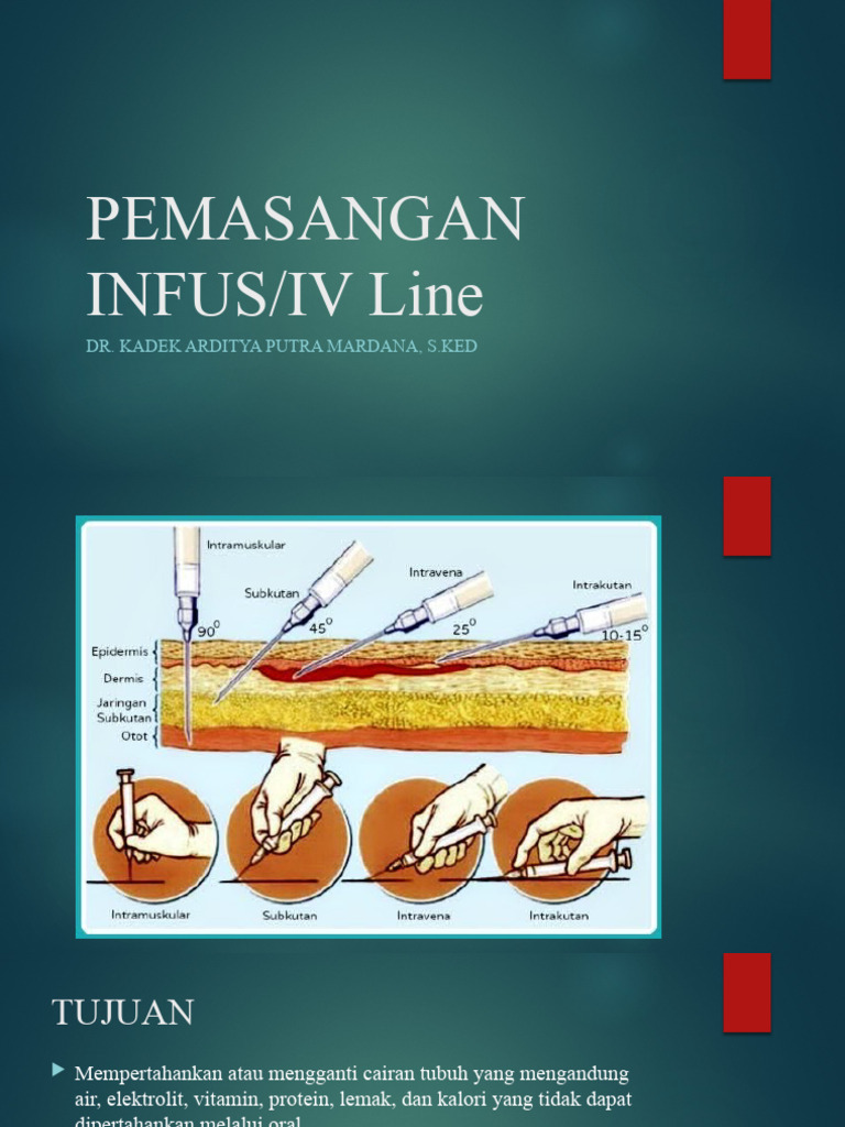 Pemasangan Infus | PDF