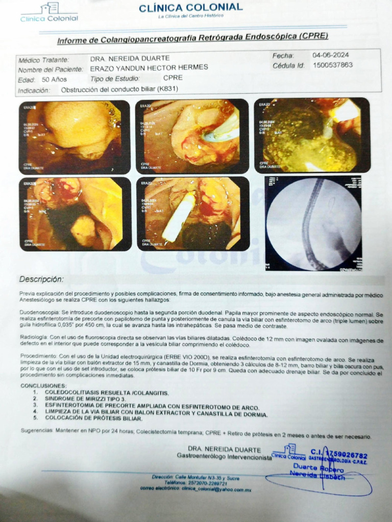 Informe CPRE y Diagnóstico de Coledocolitiasis | PDF | Hematología | Sangre